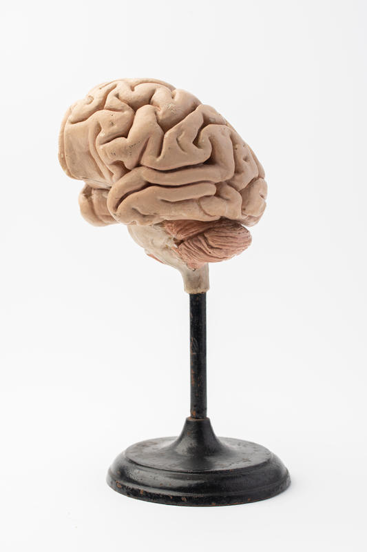 Orangutan brain model - Faculty of Medicine, Dentistry and Health ...