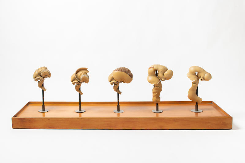 Wax Anatomical Brain Development Models Faculty Of Medicine Dentistry And Health Sciences