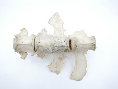Cow vertebrae - Faculty of Medicine, Dentistry and Health Sciences ...