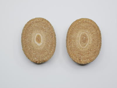 Calculus, concentric layers - Faculty of Medicine, Dentistry and Health ...