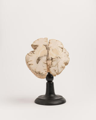Plaster model of dissected brain - Faculty of Medicine, Dentistry and ...