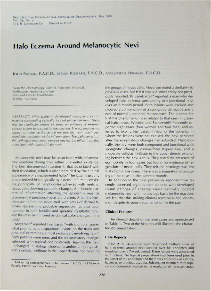 Article, 'Halo Eczema Around Melanocytic Nevi' - Faculty of Medicine ...