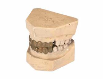 Articulated model and anterior splints - Faculty of Medicine, Dentistry ...