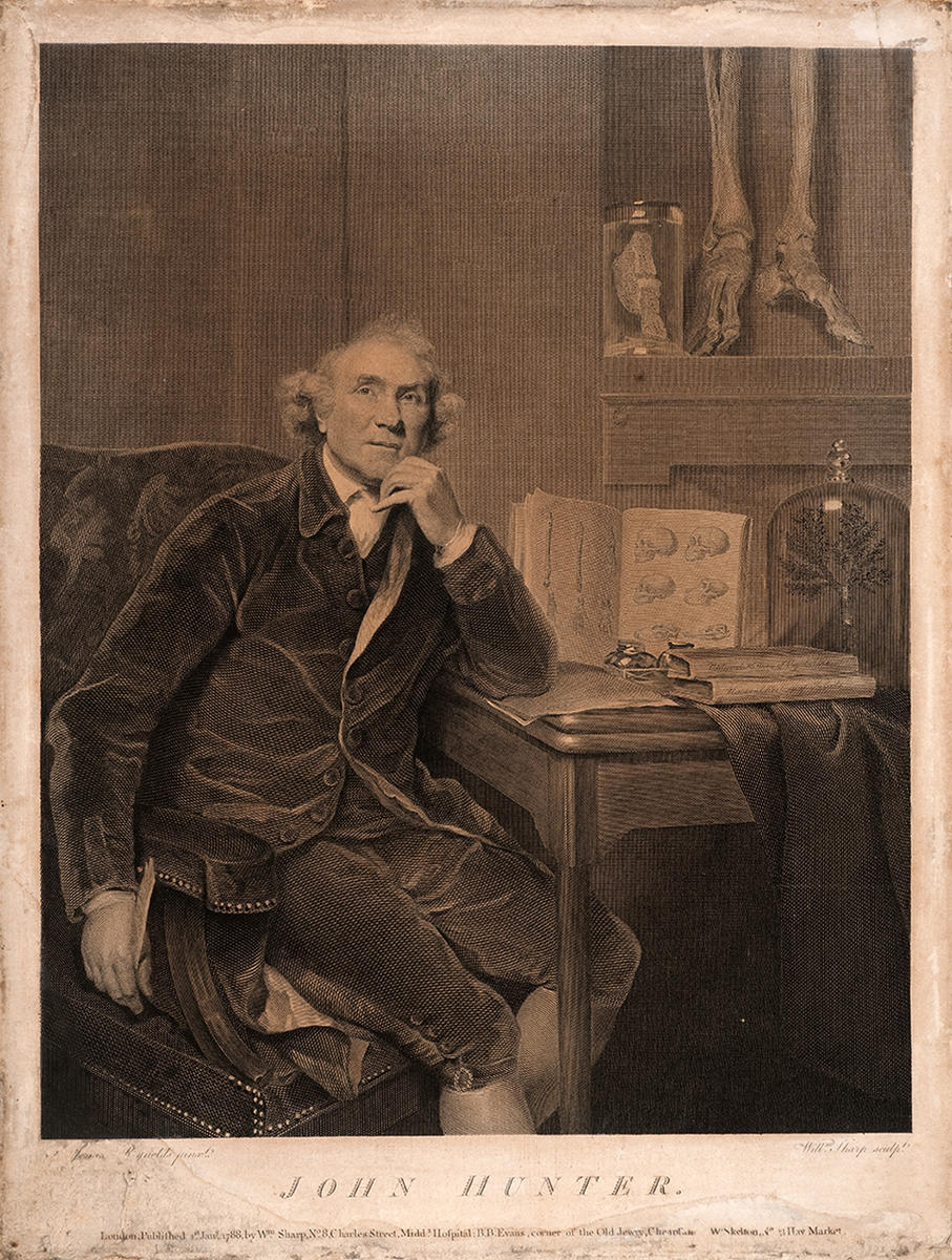 John Hunter (1728–1793) , after a painting by Sir Joshua Reynolds ...
