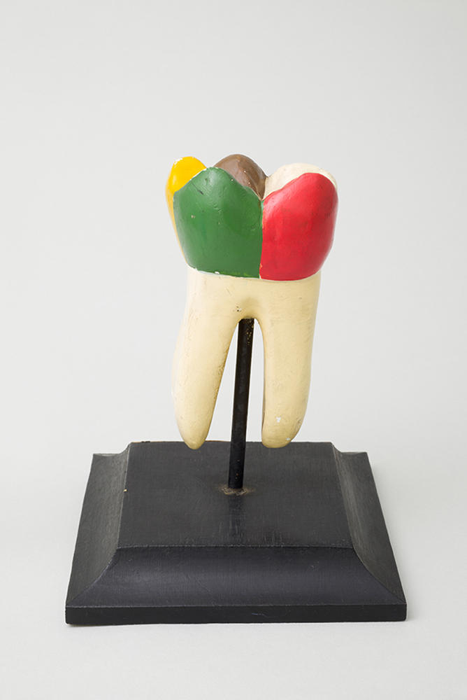 Teaching model of left lower 1st permanent molar Human (Homo sapiens ...