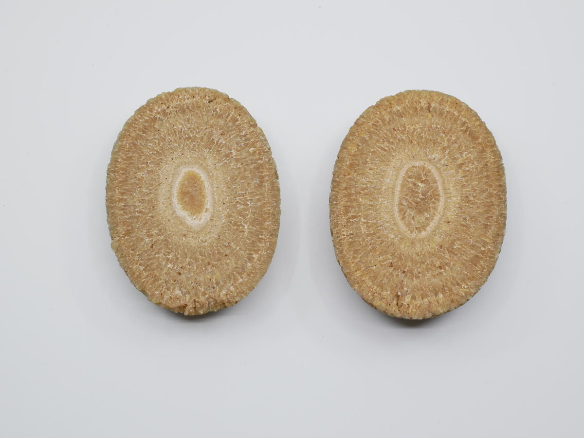 Calculus, concentric layers - Faculty of Medicine, Dentistry and Health ...