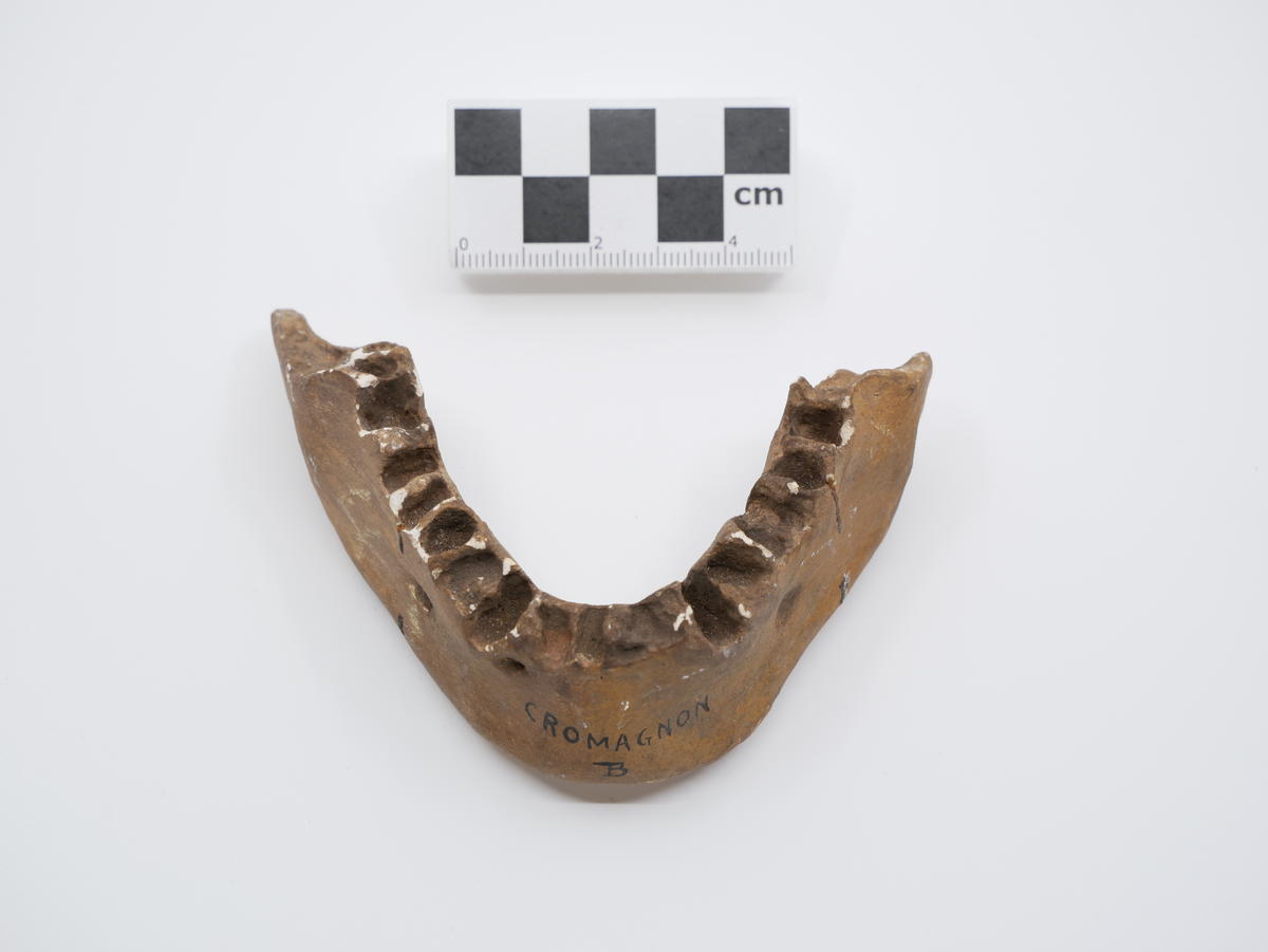 Cro-Magnon partial mandible, plaster cast - Faculty of Medicine ...