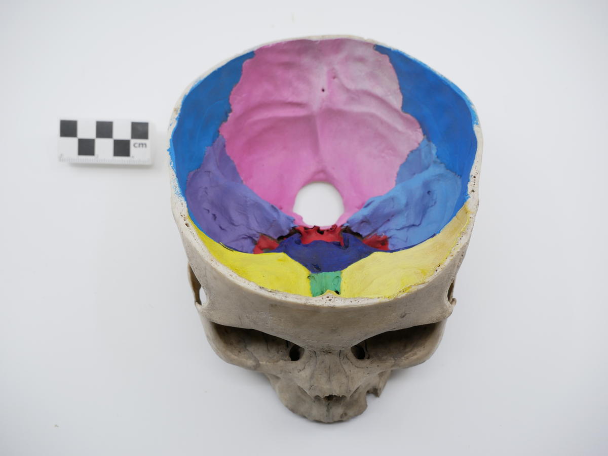 Human skull, painted - Faculty of Medicine, Dentistry and Health ...