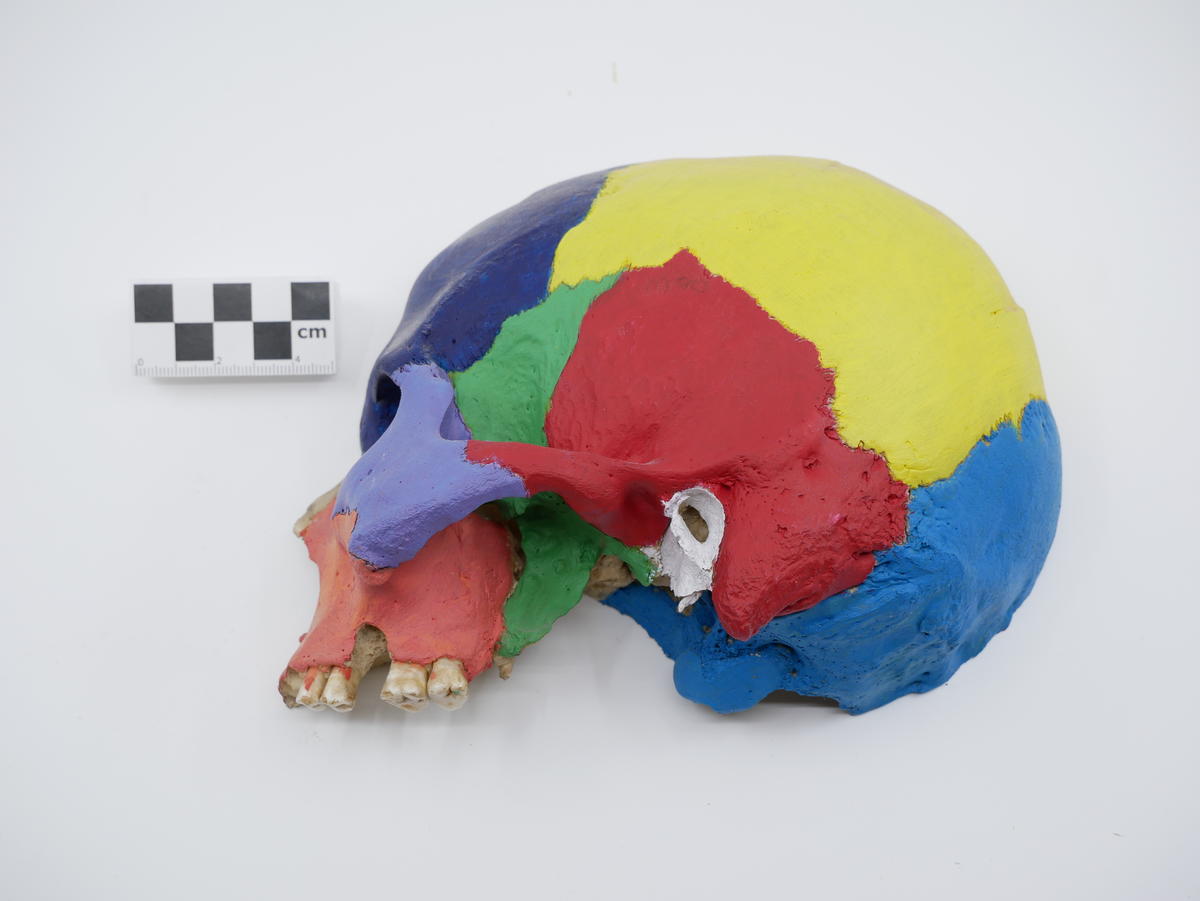 Human skull, bisected and painted - Faculty of Medicine, Dentistry and ...