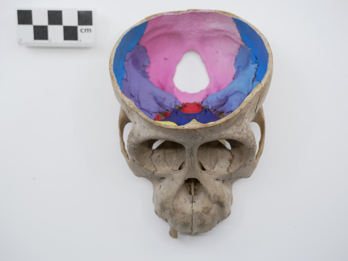Orangutan skull, painted - Faculty of Medicine, Dentistry and Health ...