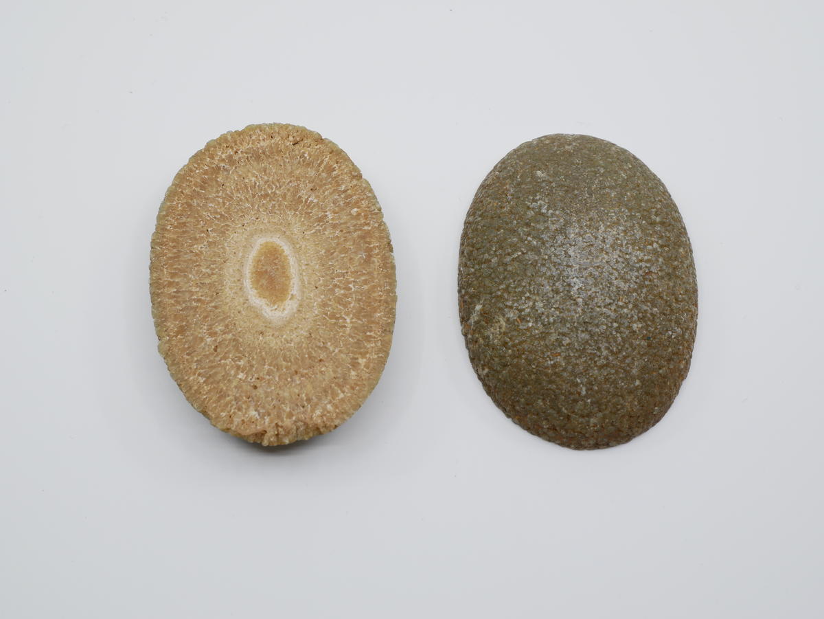 Calculus, concentric layers - Faculty of Medicine, Dentistry and Health ...