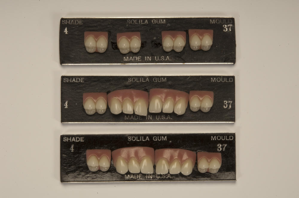 Porcelain gum blocks - Faculty of Medicine, Dentistry and Health ...