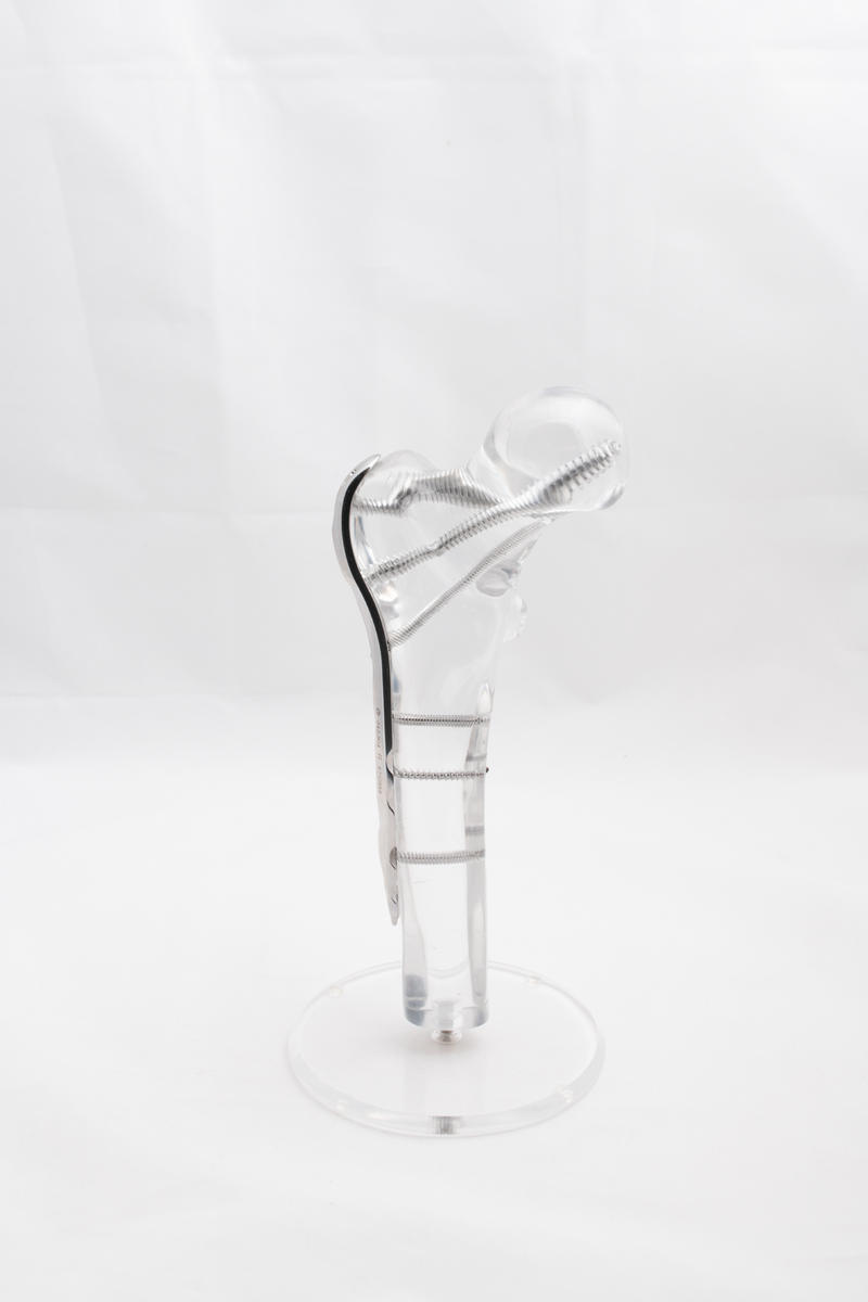 Model of proximal femur and plate - Faculty of Medicine, Dentistry and ...