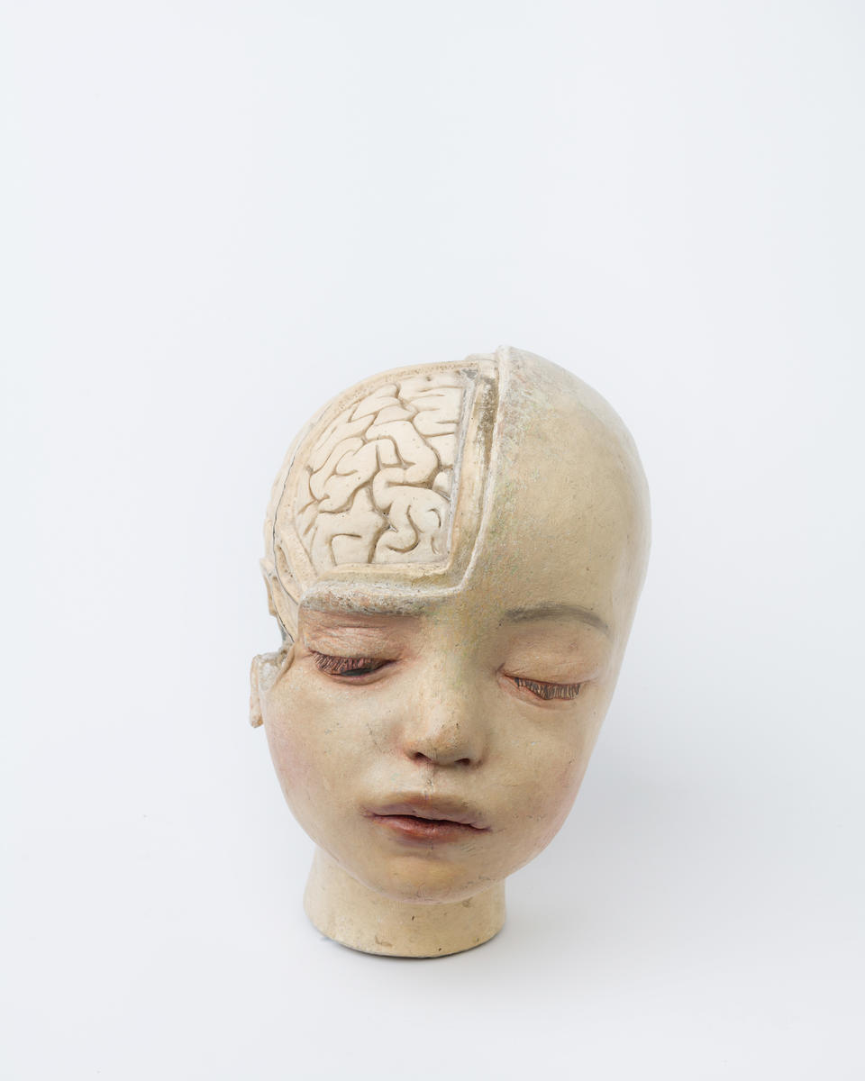 Model of the head of a child, brain exposed - Faculty of Medicine ...