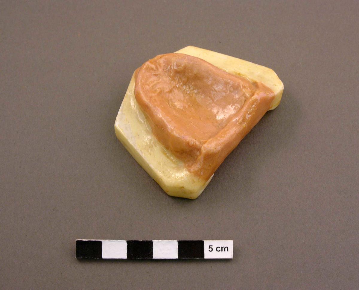 Model: Prosthetic Including Mask of Lower Face - Faculty of Medicine ...