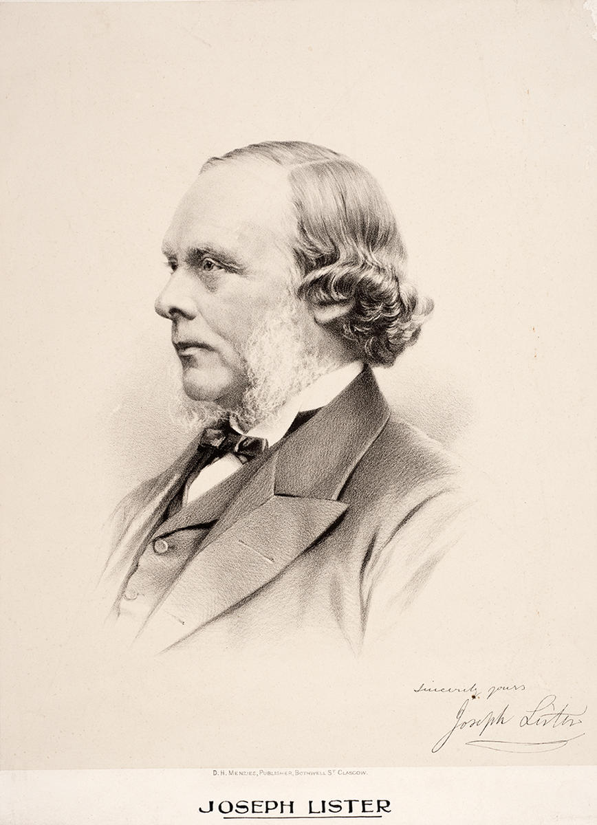 Joseph Lister (1827-1912) - Faculty of Medicine, Dentistry and Health ...